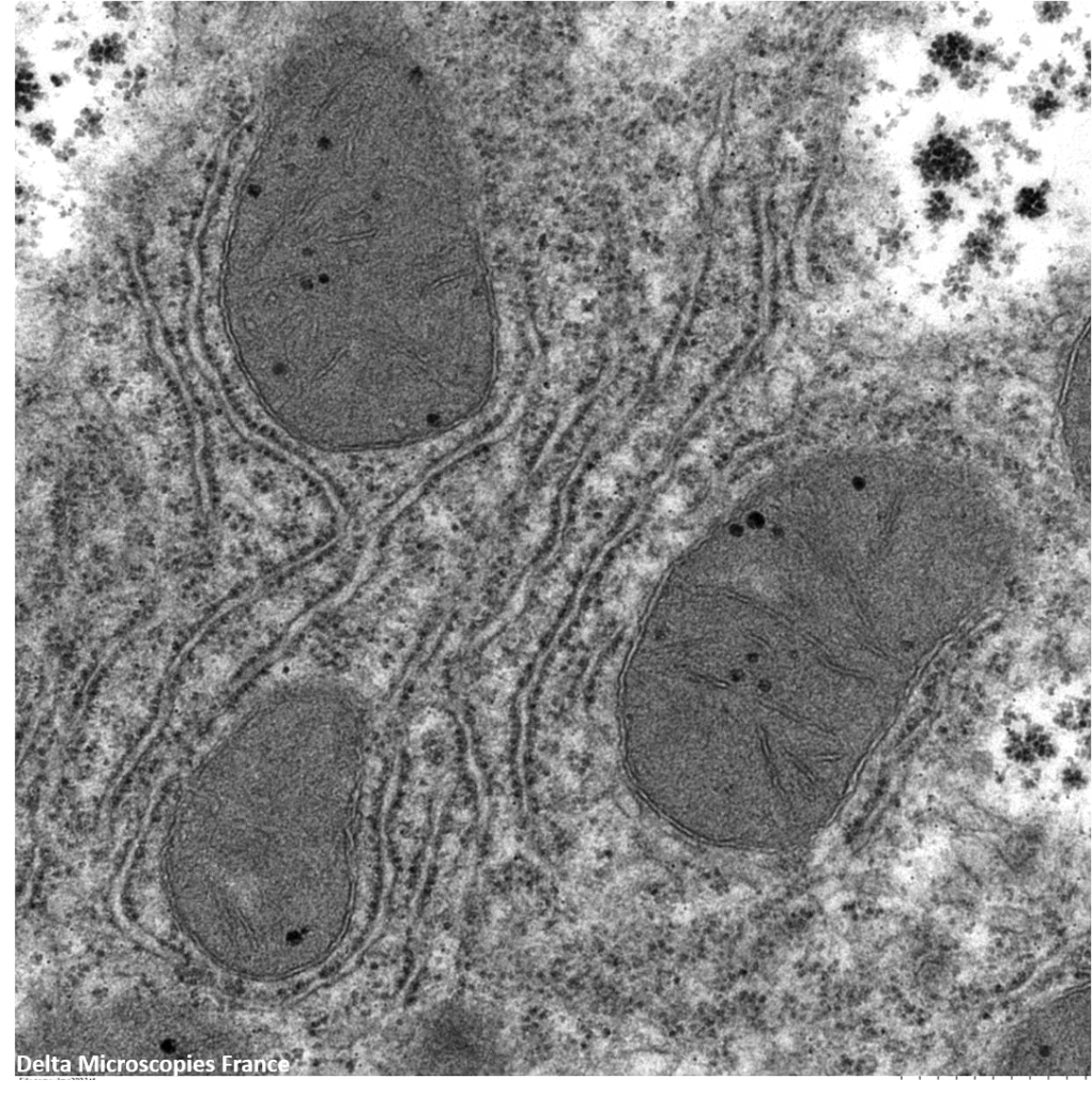 Lead Citrate | Uranyless