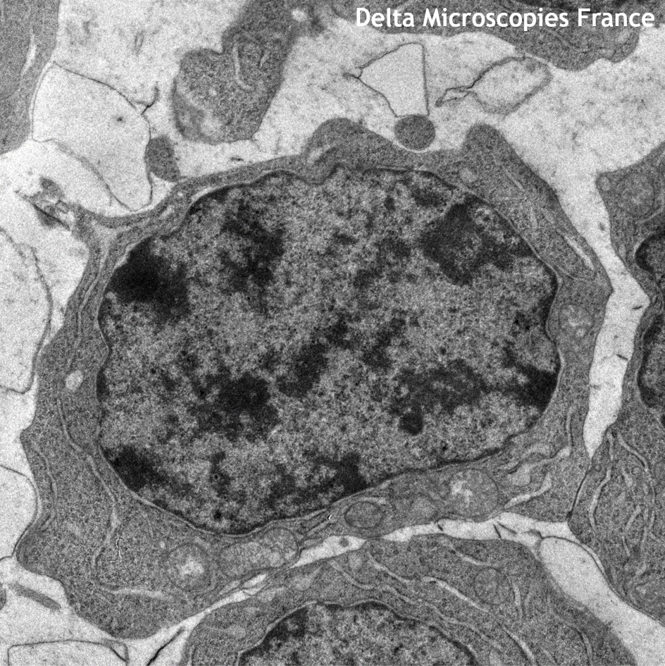 Uranyless aqueous | Fixative solution