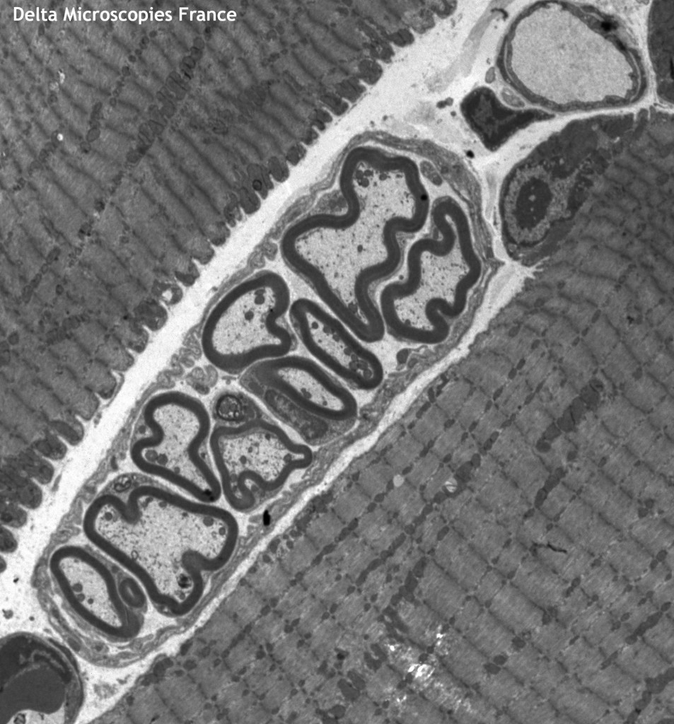 Uranyless aqueous | Fixative solution