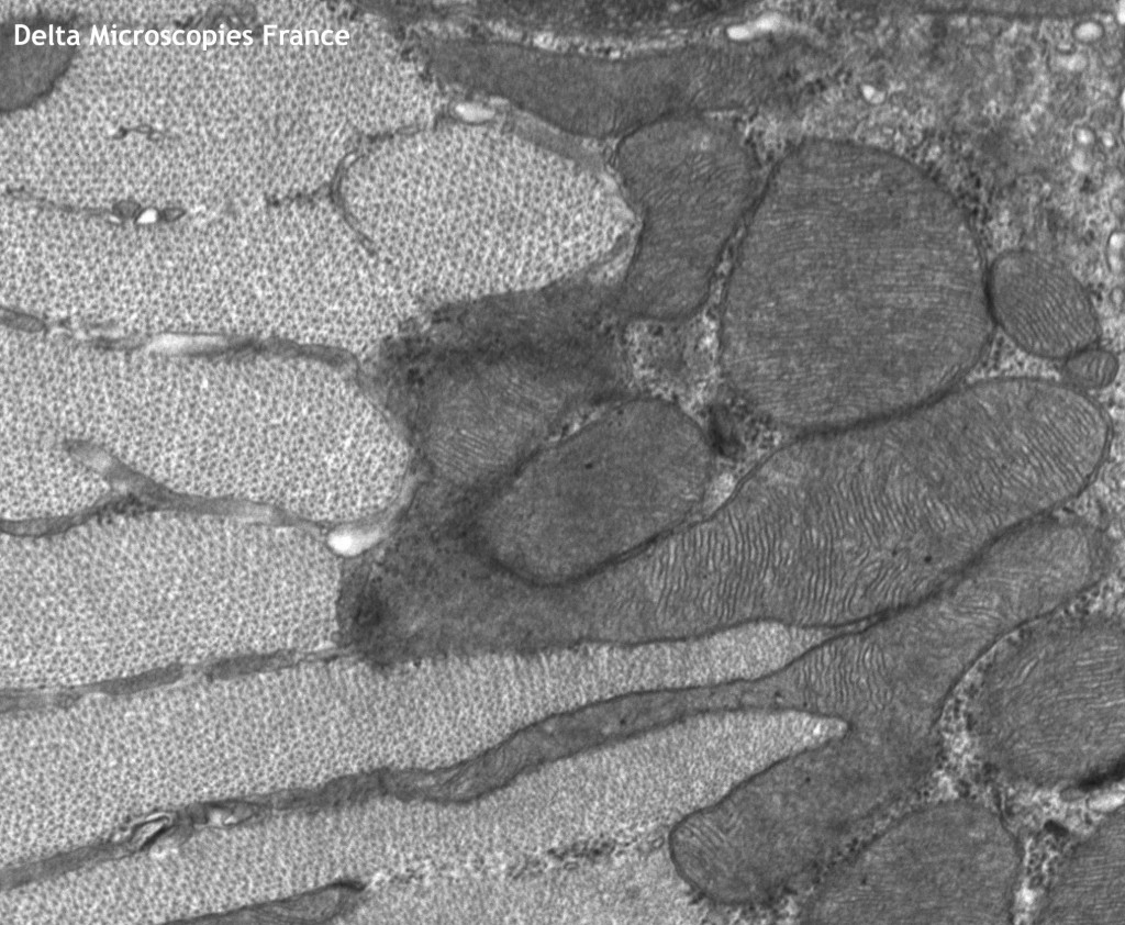 Uranyless aqueous | Fixative solution