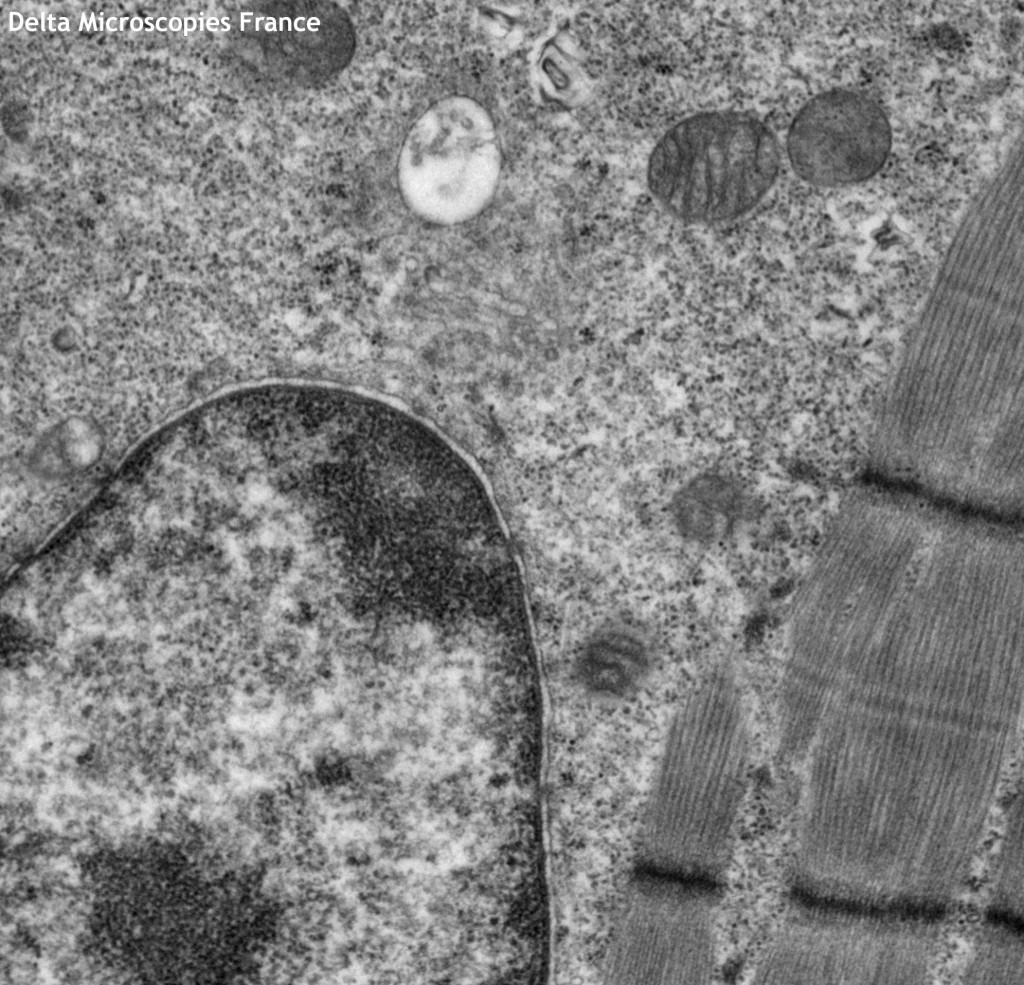 Uranyless aqueous | Fixative solution