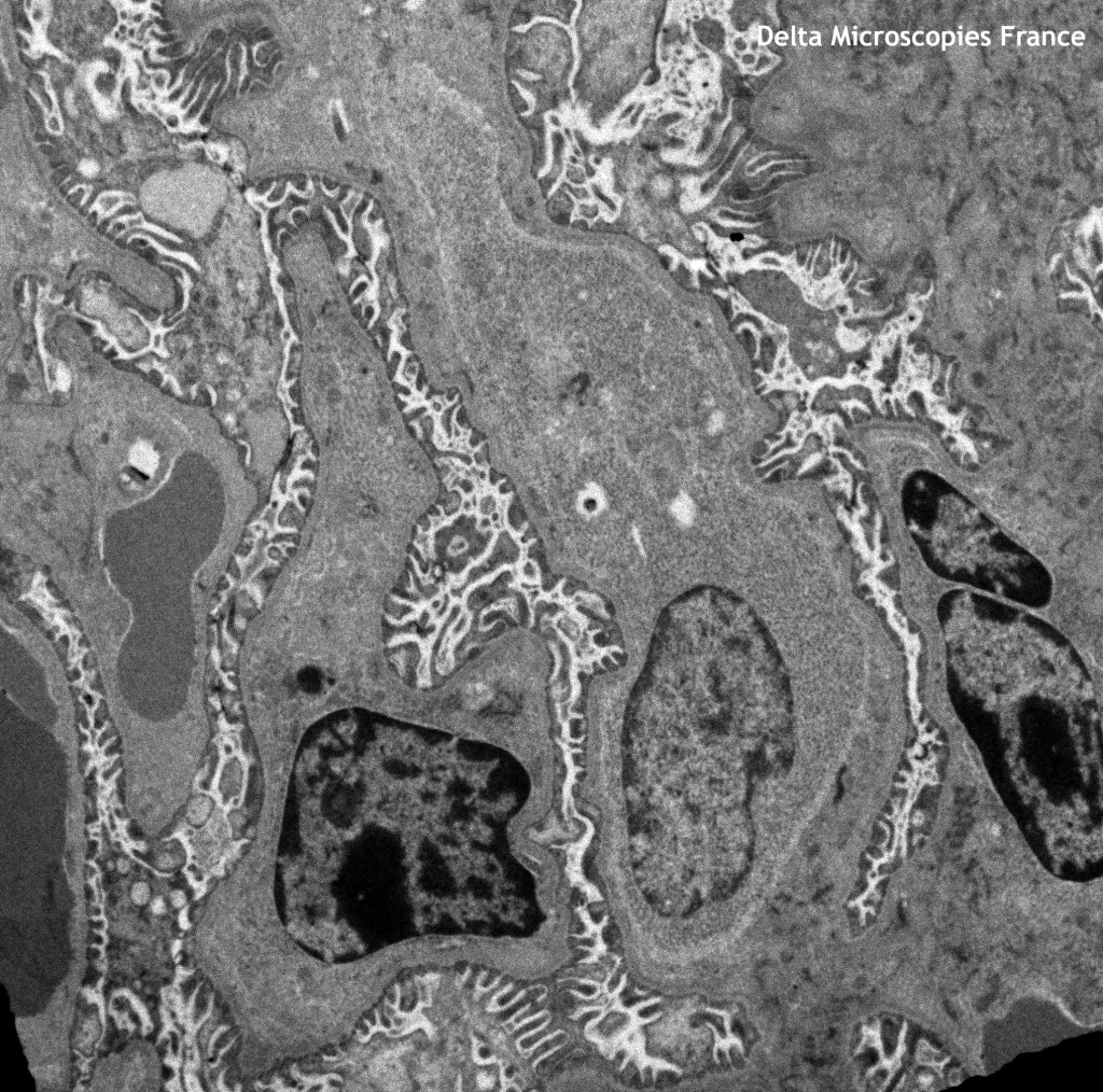 Uranyless aqueous | Fixative solution