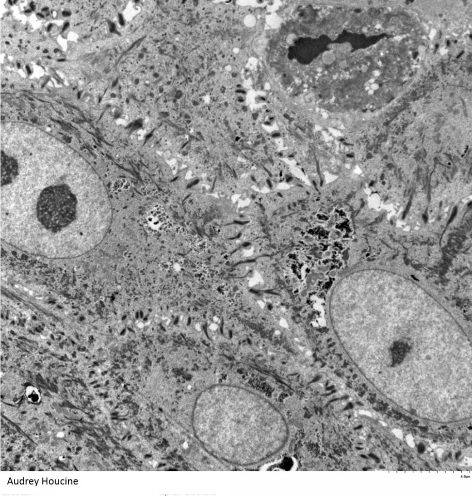 Uranyless aqueous | Fixative solution