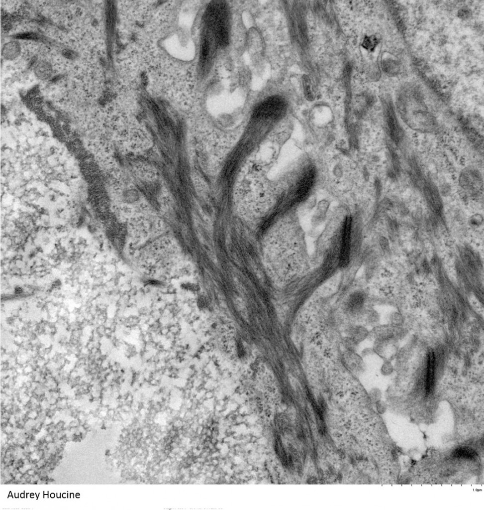 Uranyless aqueous | Fixative solution