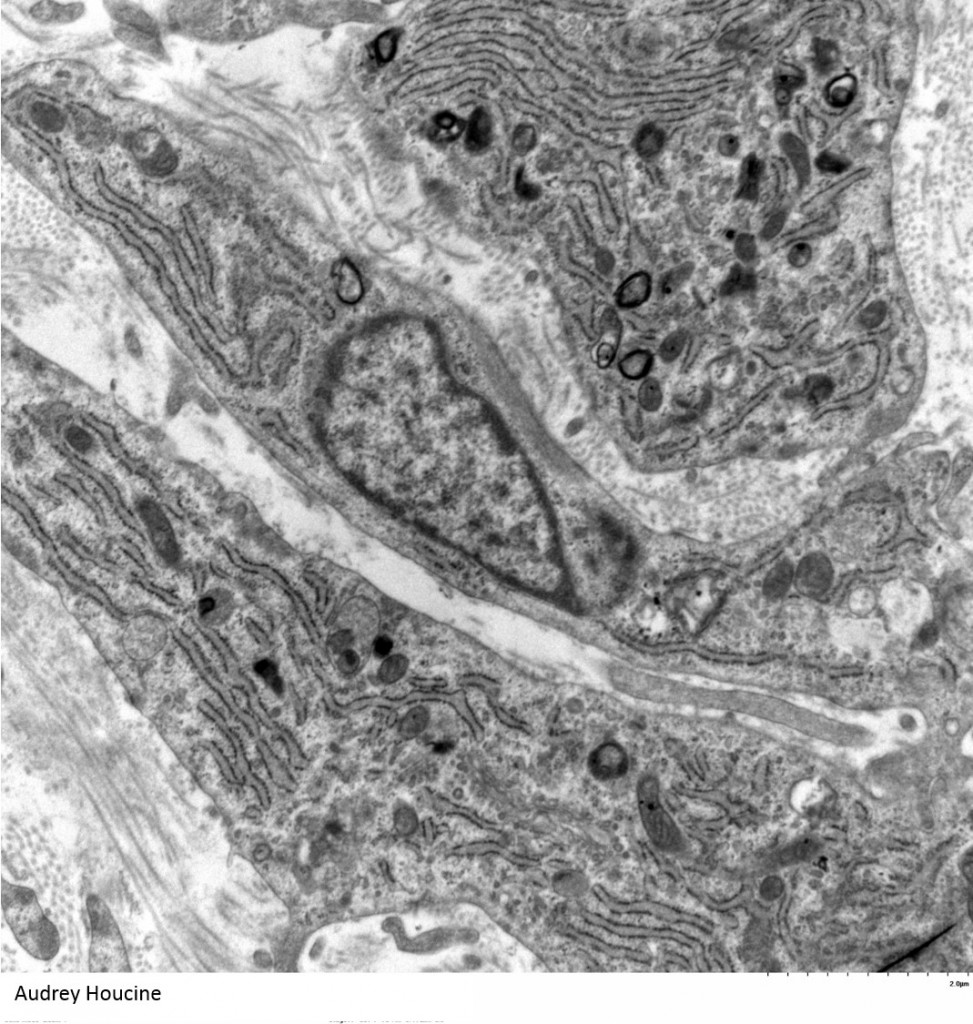 Uranyless aqueous | Fixative solution