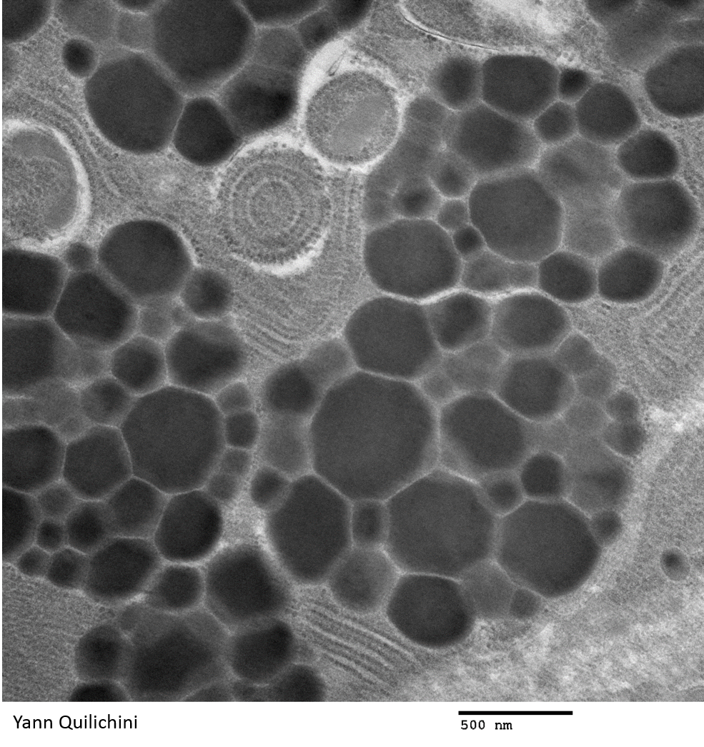 Uranyless aqueous | Fixative solution