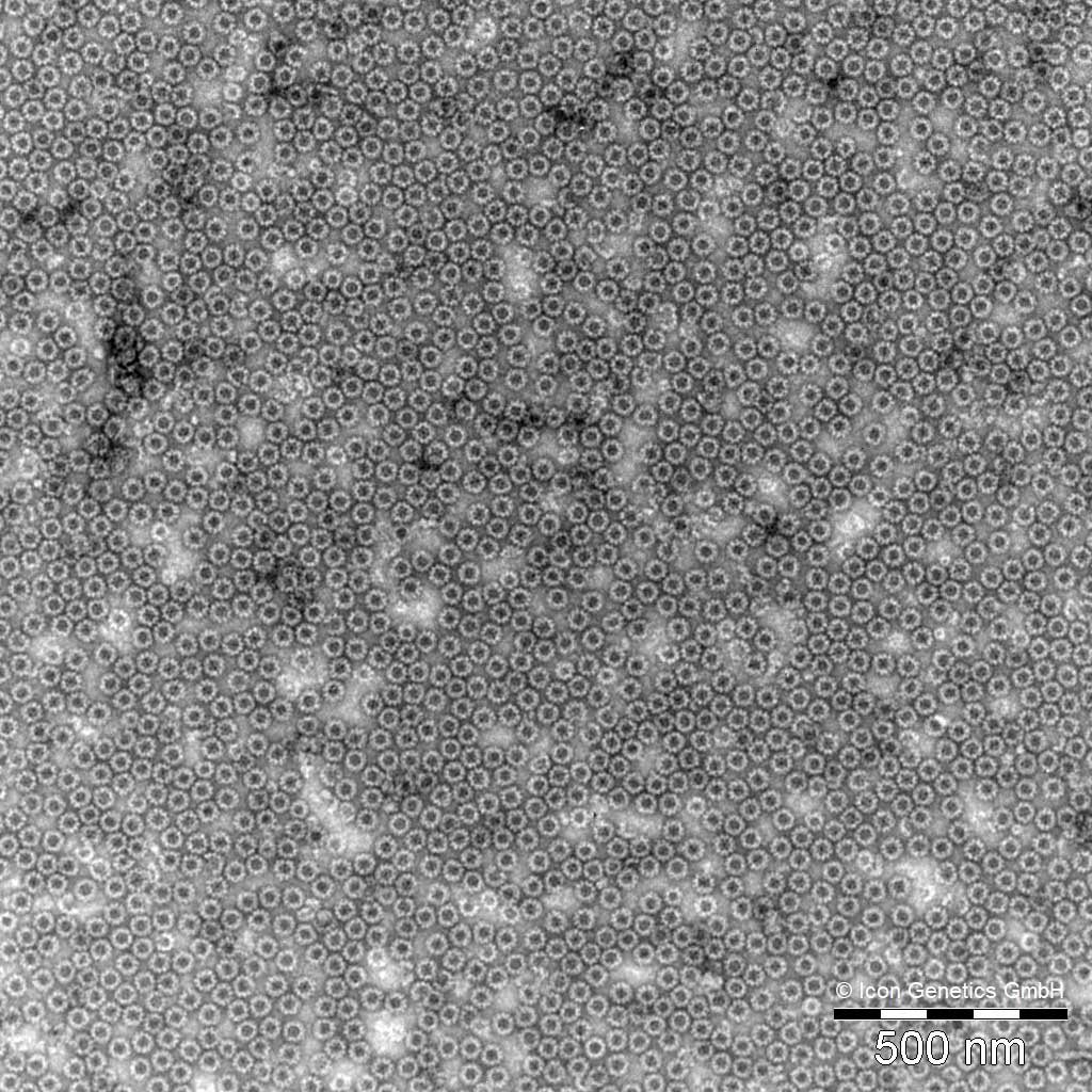 Negative Stain - Uranyless