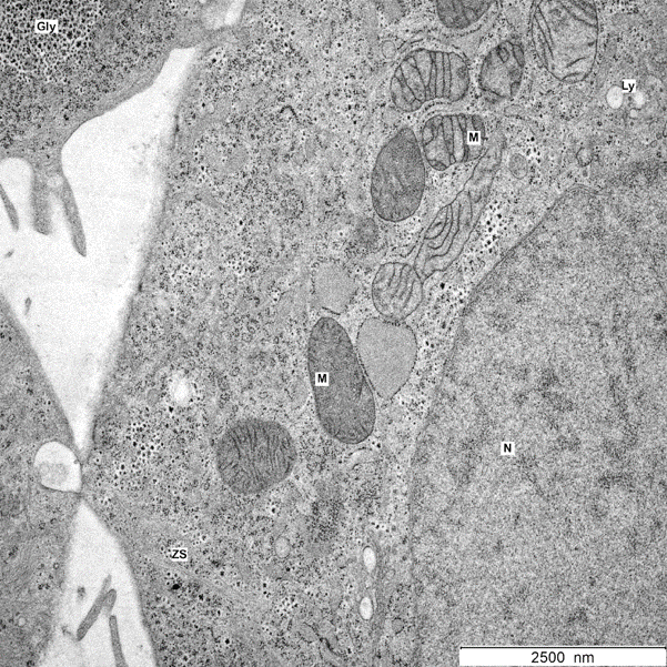 Uranyless | EM-Stain