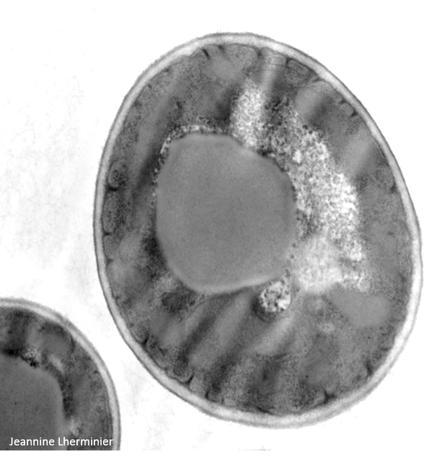 Uranyless aqueous | Fixative solution