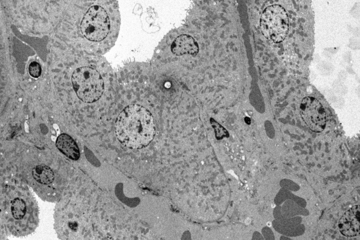 Uranyless aqueous | Fixative solution