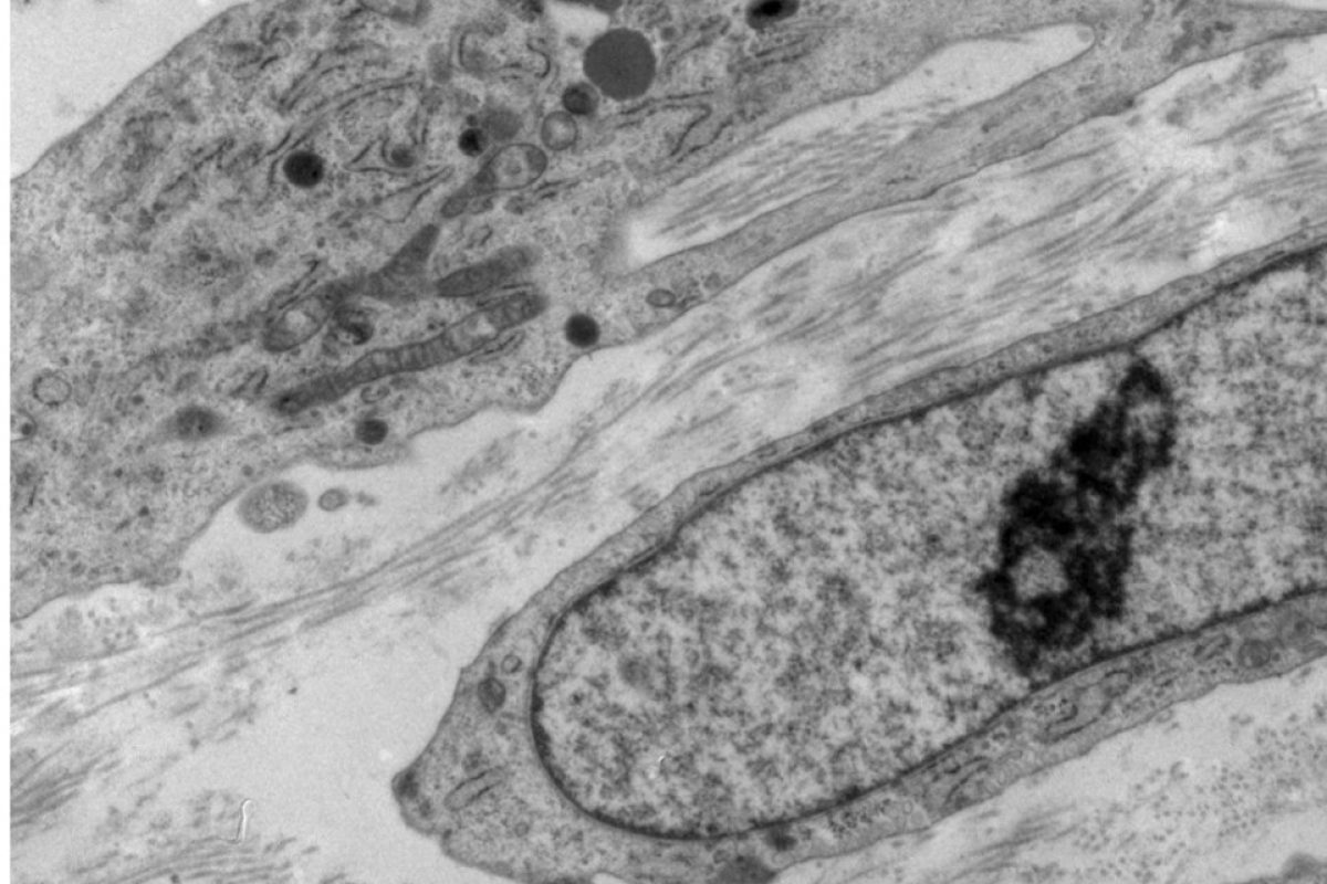 Uranyless aqueous | Fixative solution