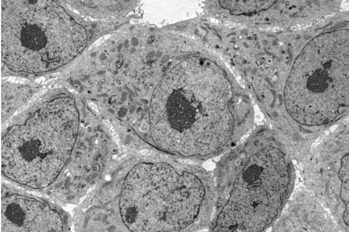 Uranyless aqueous | Fixative solution