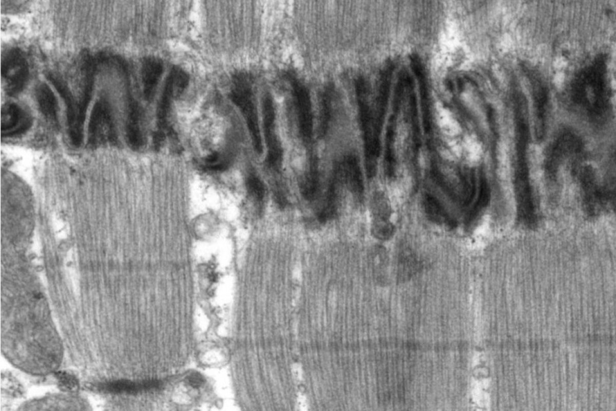 Uranyless aqueous | Fixative solution