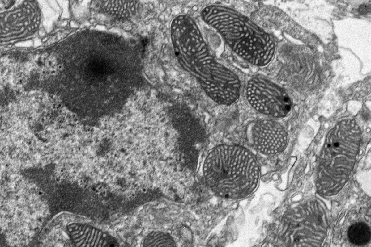 Uranyless aqueous | Fixative solution